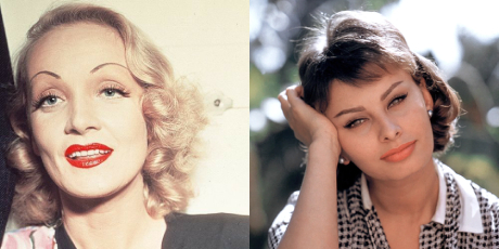 Upper Eyelid Aesthetic Surgery